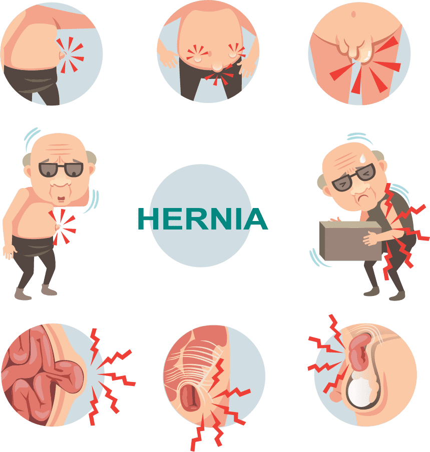 Bruchoperation: Leistenbruch | Dr. Sonja Nakhai in Maria Enzersdorf